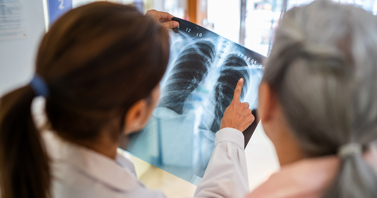 Lung Nodules Explained: What You Need to Know | American Lung Association