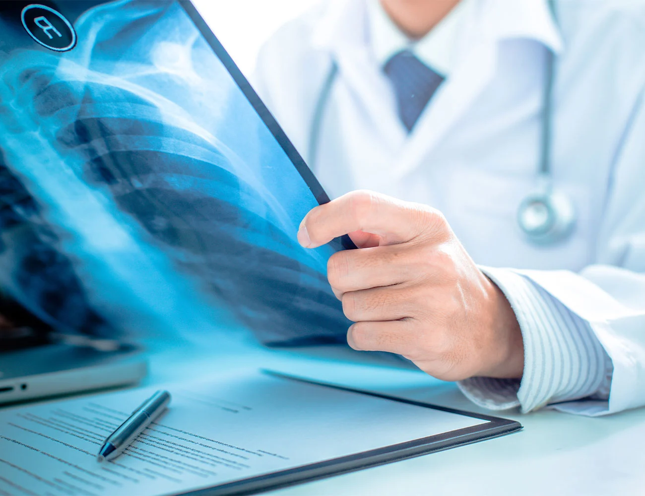 Lung Cancer Staging | American Lung Association