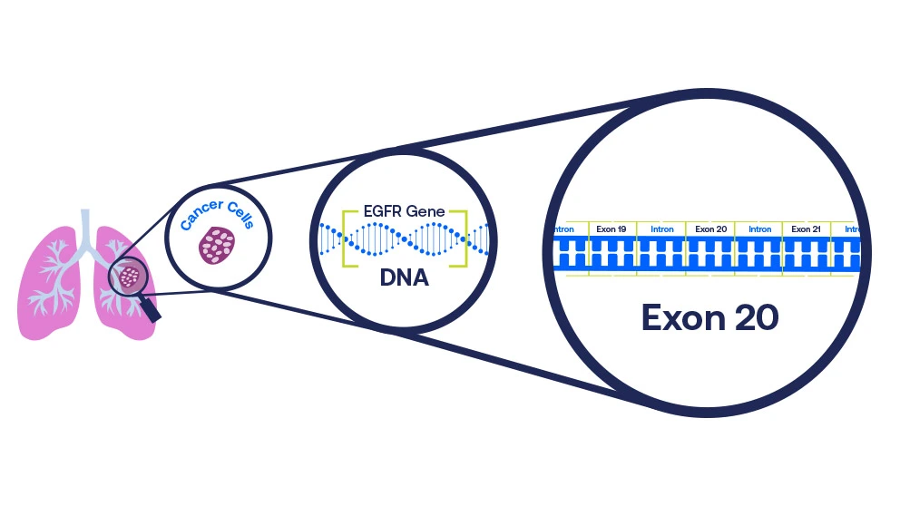 Egfr Exon 20 Insertion Mutation And Lung Cancer American Lung Association