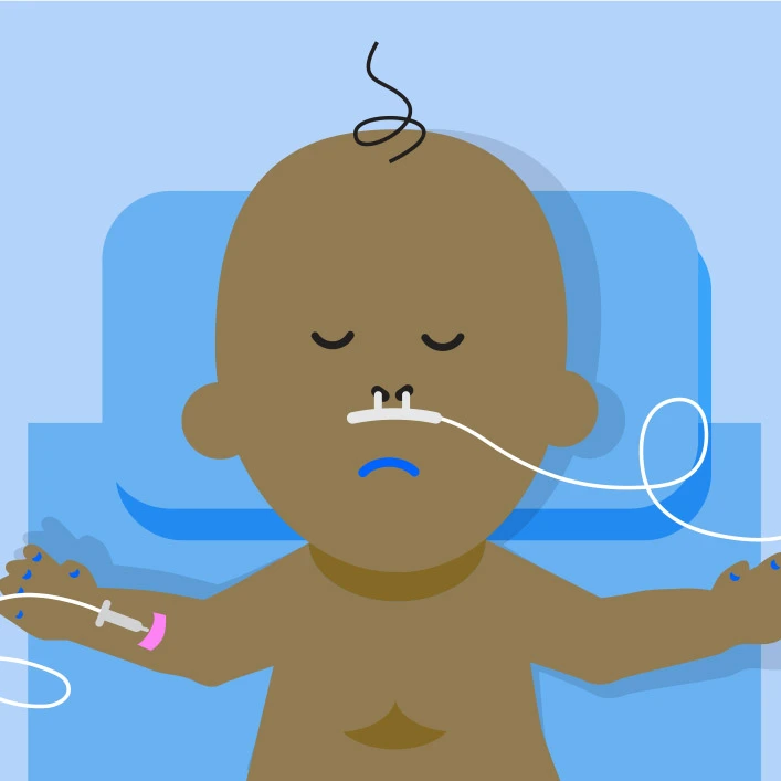 RSV Prevention and Treatment | American Lung Association