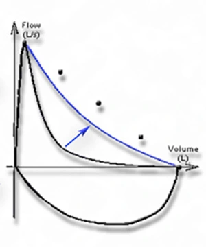 Rethinking Asthma Testing: New ACRC Study Challenges the Bronchodilator ...