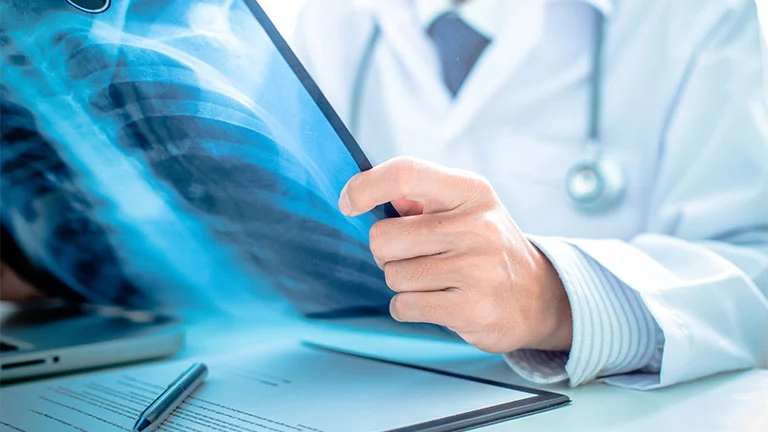 Lung Cancer Staging | American Lung Association
